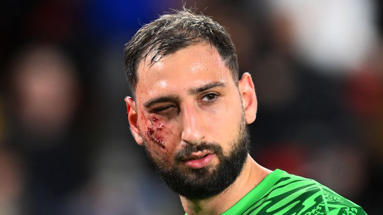 Donnarumma sufre lesión contundente: ¿accidente o imprudencia del ...
